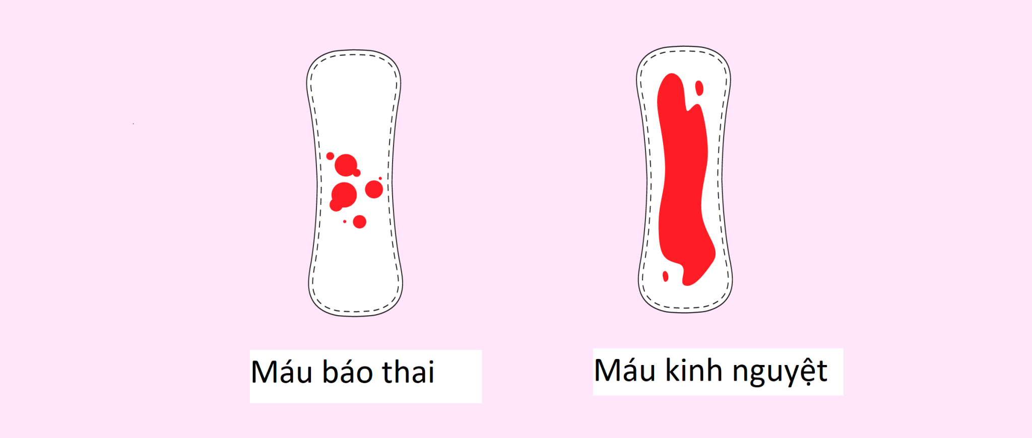 Máu báo thai xuất hiện sau khi chậm kinh bao lâu?